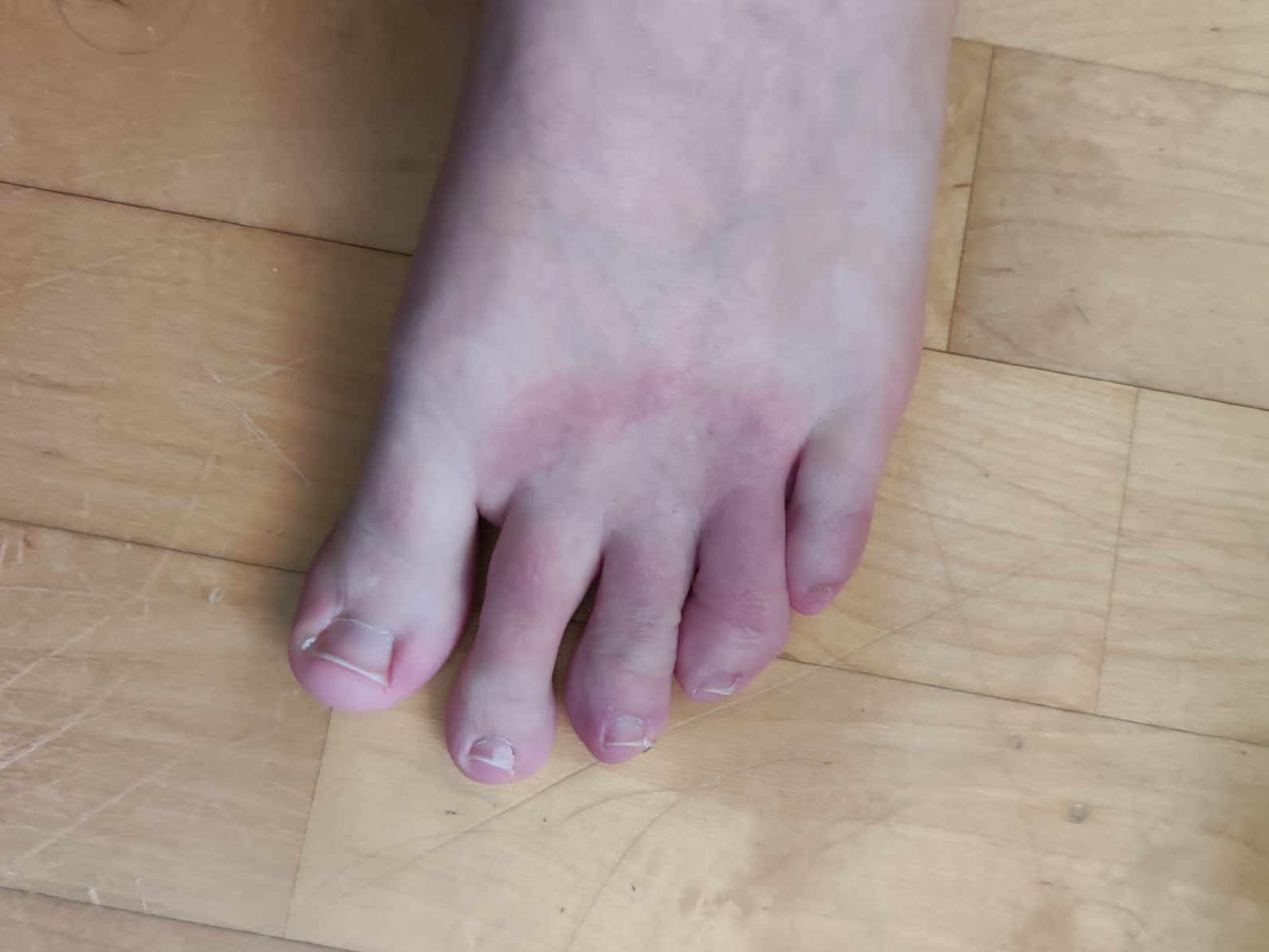 All you need to know about ticks in Finland